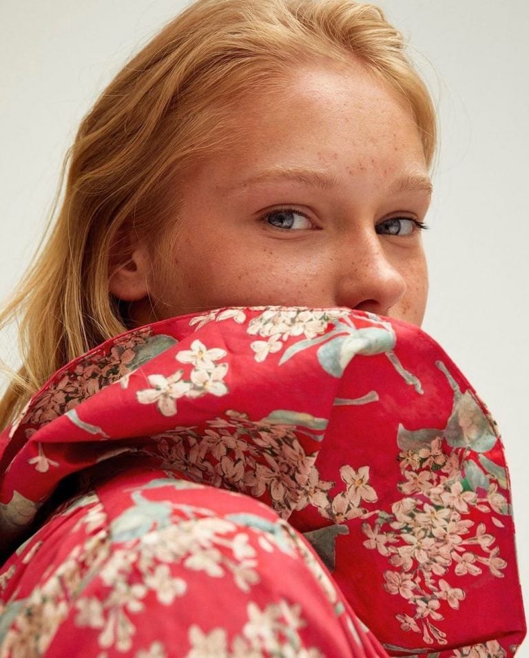 ¿Qué es la rosácea? Síntomas, causas y factores de riesgo