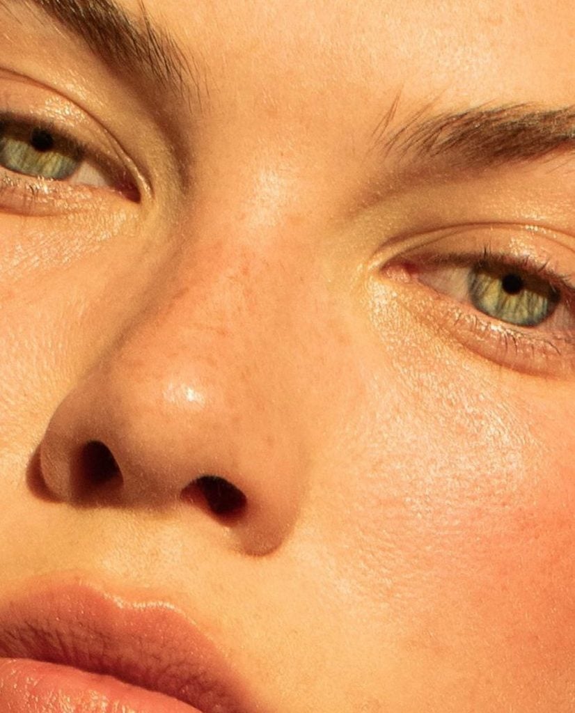 ¿Qué es la rosácea? Síntomas, causas y factores de riesgo