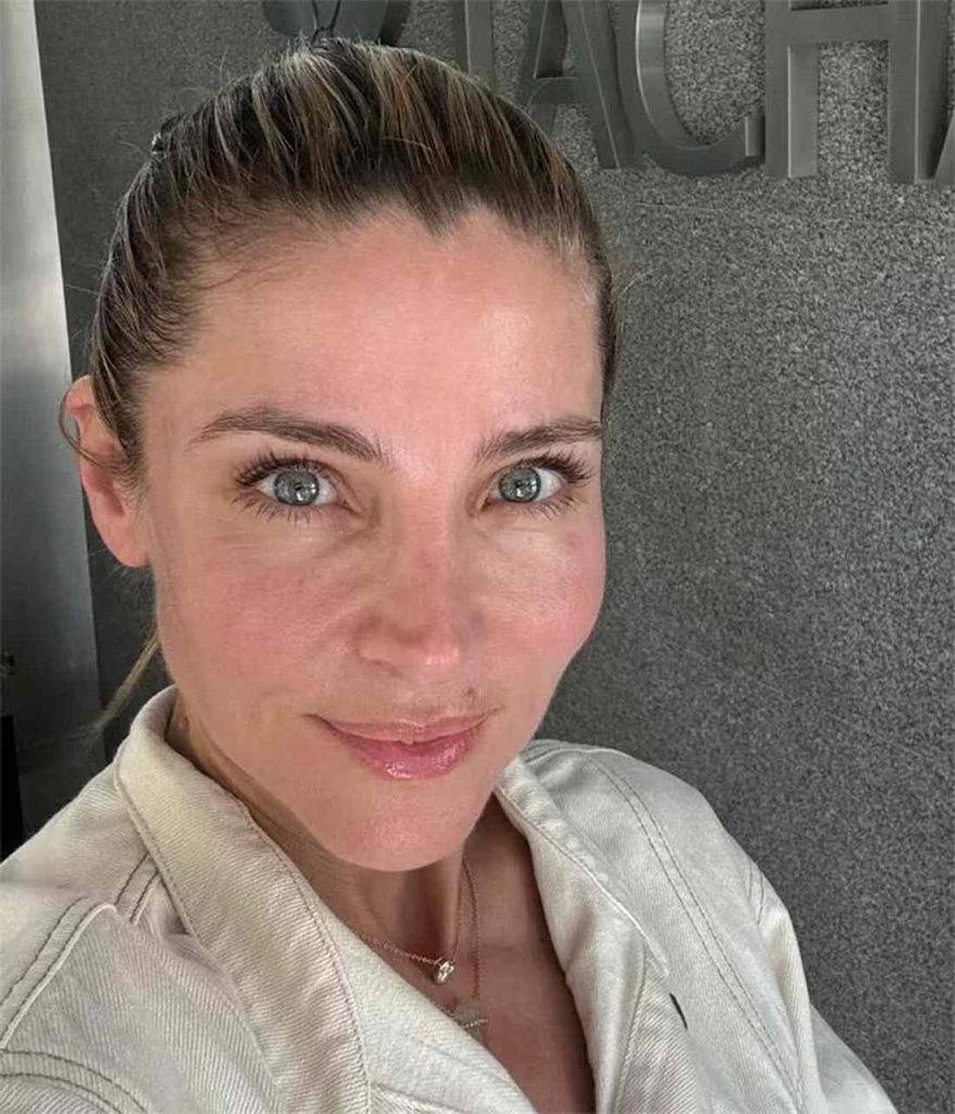 El tratamiento antiedad con láser y sin cirugía favorito de Elsa Pataky