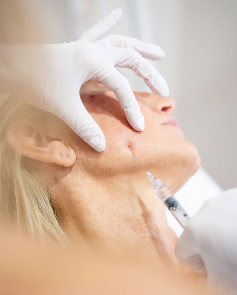 Dra. Paula Rosso sobre mitos y verdades del ácido hialurónico: "Es falsa la idea de que sea ...