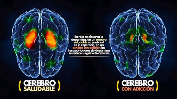 ¿Cómo funciona el sistema de recompensa del cerebro?