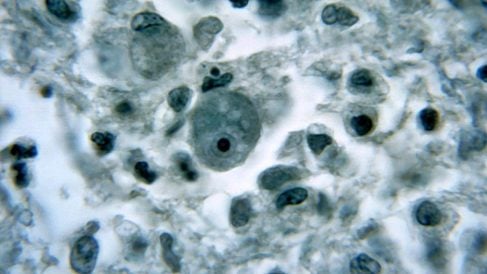 Amebas: Los parásitos intestinales que causan la Amebiasis