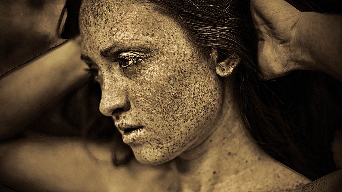 Qué son y cómo se producen las pecas