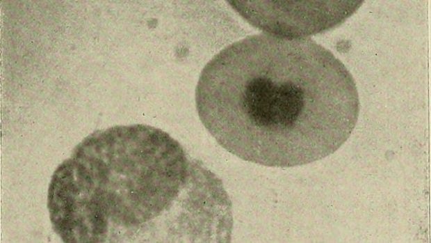 Monocitos: ¿Cuáles son los valores normales de monocitos?