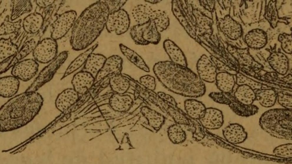 Extravasación: definición y tipos