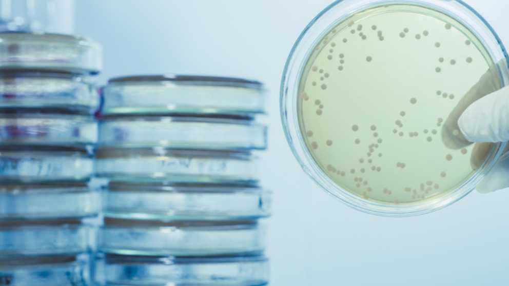 Legionelosis: Descubre qué es