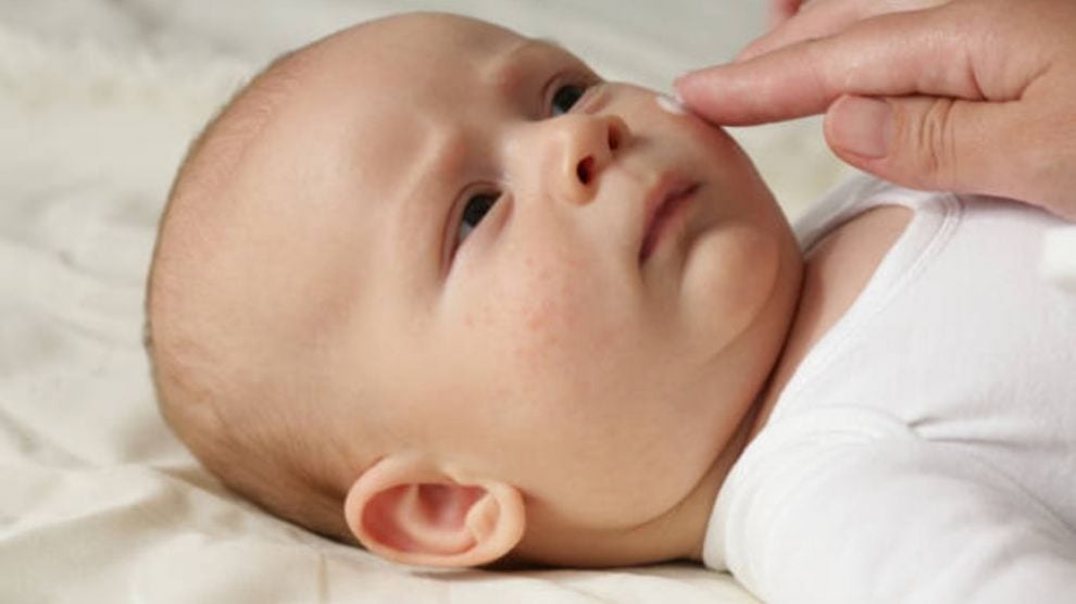 La costra láctea: qué es y cómo tratarla para eliminarla correctamente