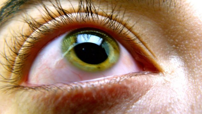 ¿Cuál es la causa de las manchas rojas en los ojos?