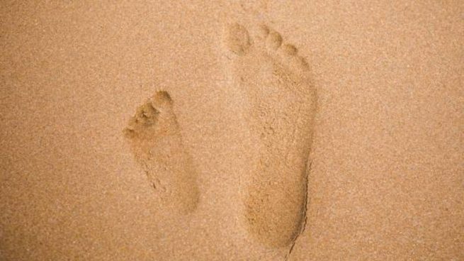 Síndrome de Proteus: Qué es, causas y cuál es el tratamiento