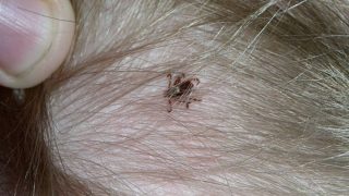 Garrapatas y niños: Cómo prevenir y cómo tratar para quitarlas