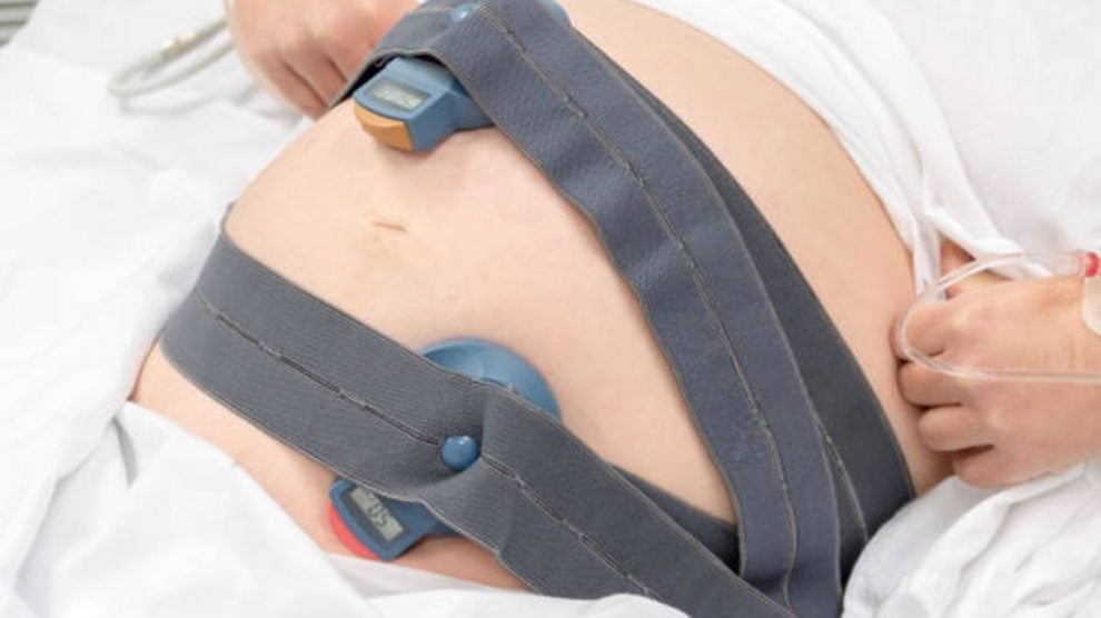 ¿Qué es el parto inducido y cuándo es necesario?