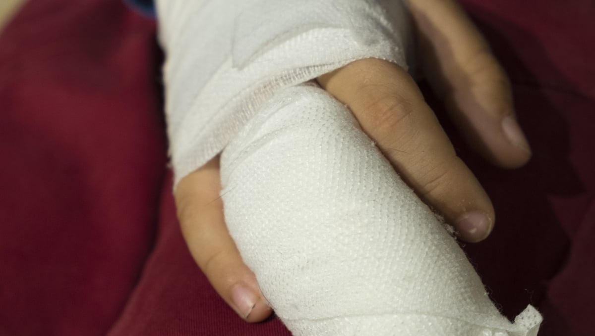 Primeros auxilios para un dedo torcido, roto o dislocado