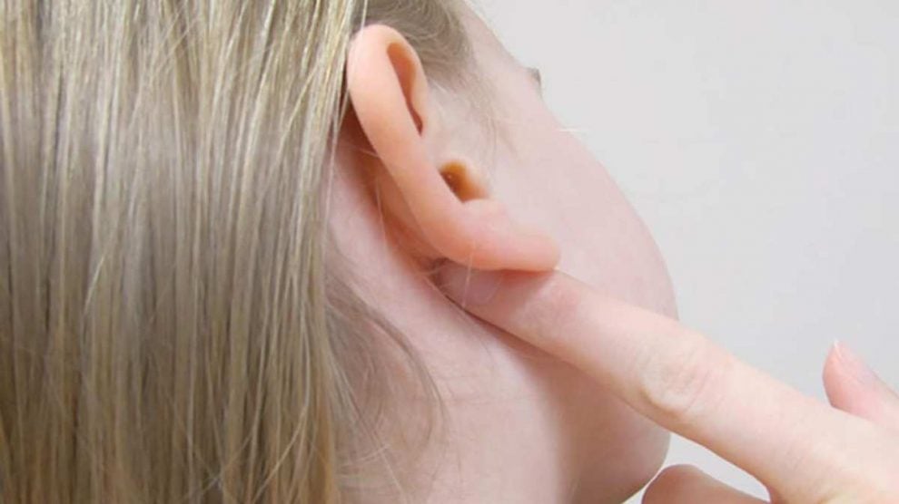 Irritación detrás de las orejas, causas y prevención