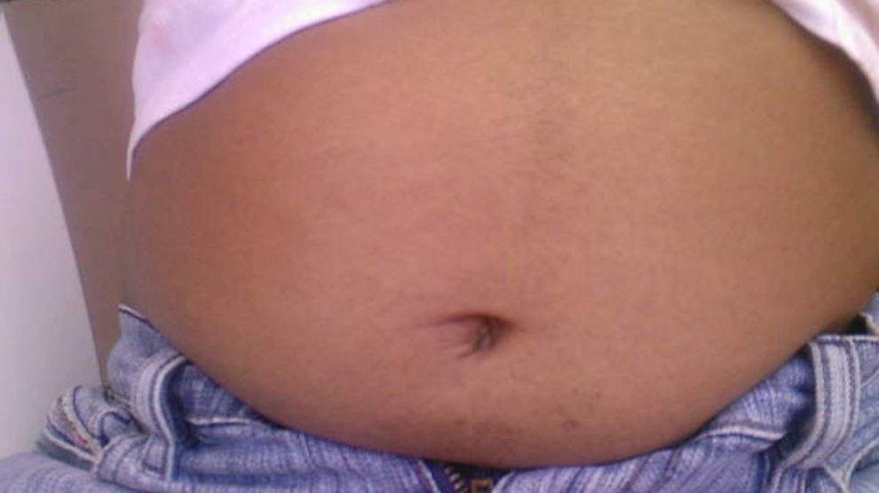 Lo que indican los tipos de barriga diferente