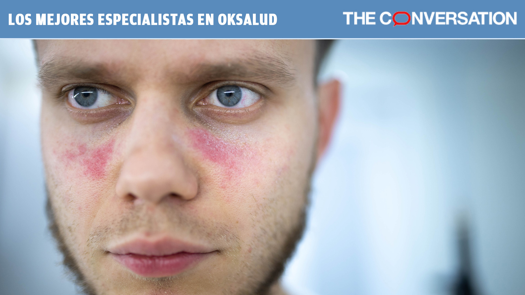 Así funciona la nueva terapia que puede poner contra las cuerdas al lupus