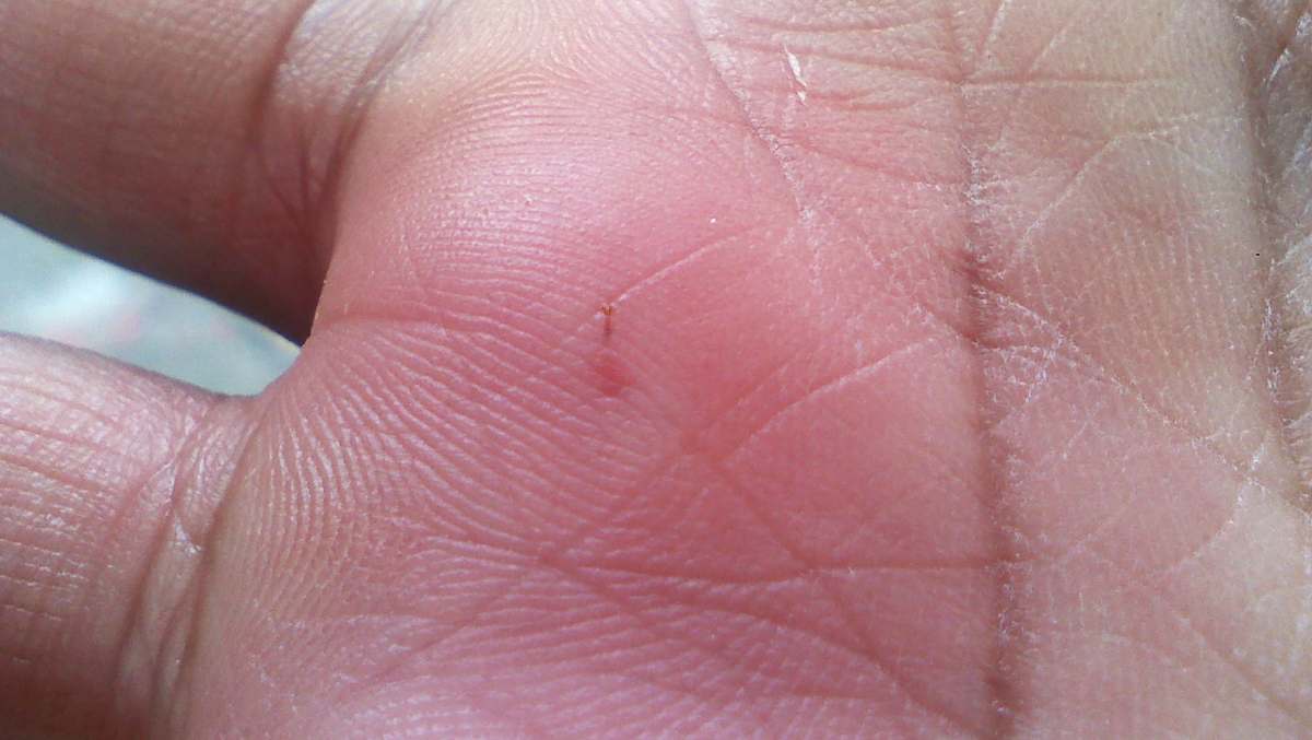 ¿Cómo ha sido el brote de dengue en Latinoamérica?