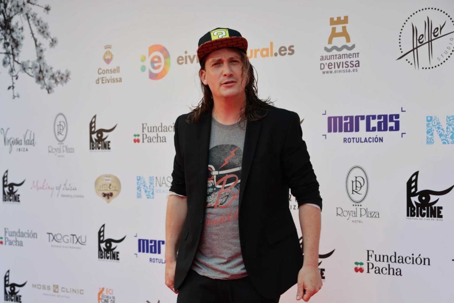 El antes y después de Grison: su impactante cambio físico y qué dieta ...