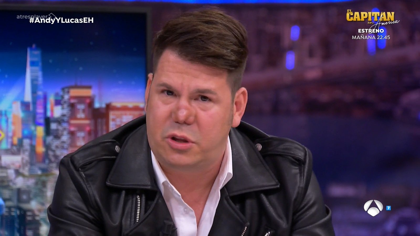 Lucas, de Andy y Lucas, se rompe al hablar de su operación de nariz: "Ha sido totalmente culpa mía"