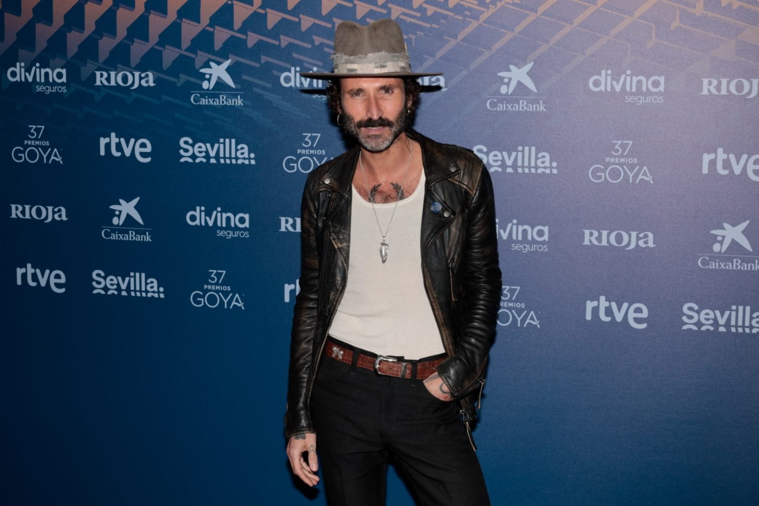 Así fue el accidente que hizo que Leiva perdiera un ojo y el suceso que ...