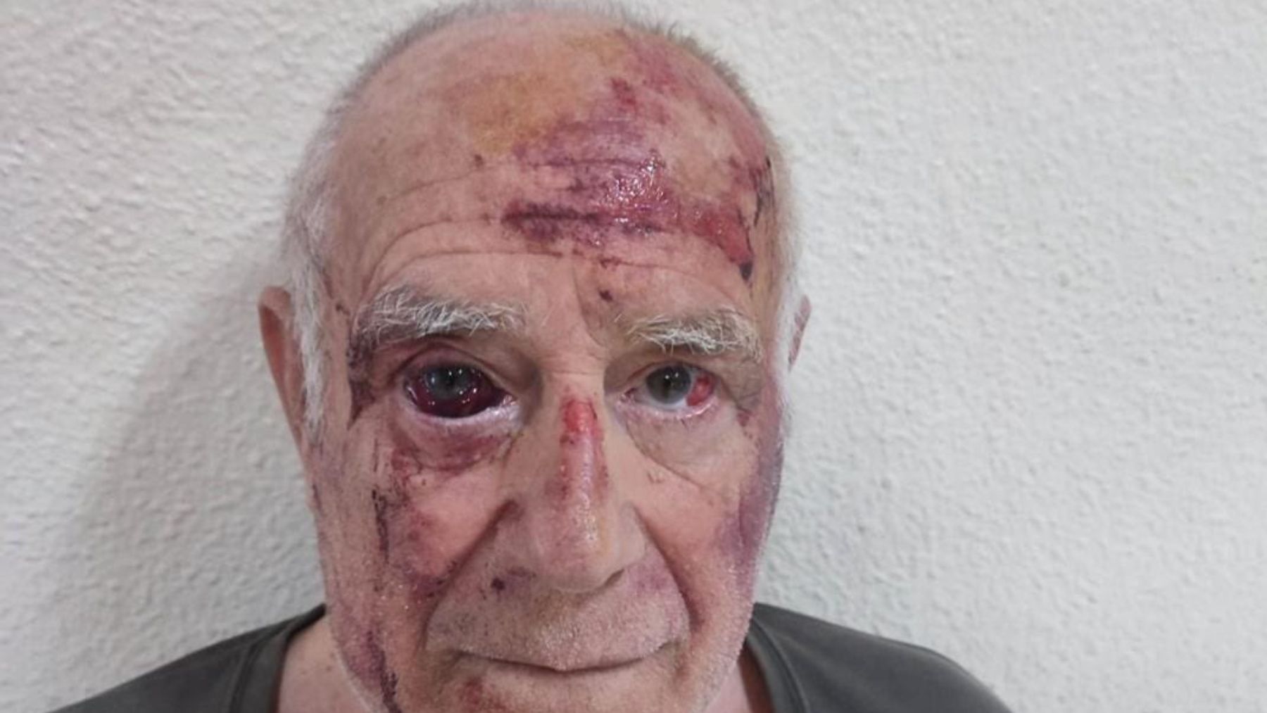 El anciano apaleado en Torre Pacheco renuncia a acusar a sus agresores por "la presión social y ...