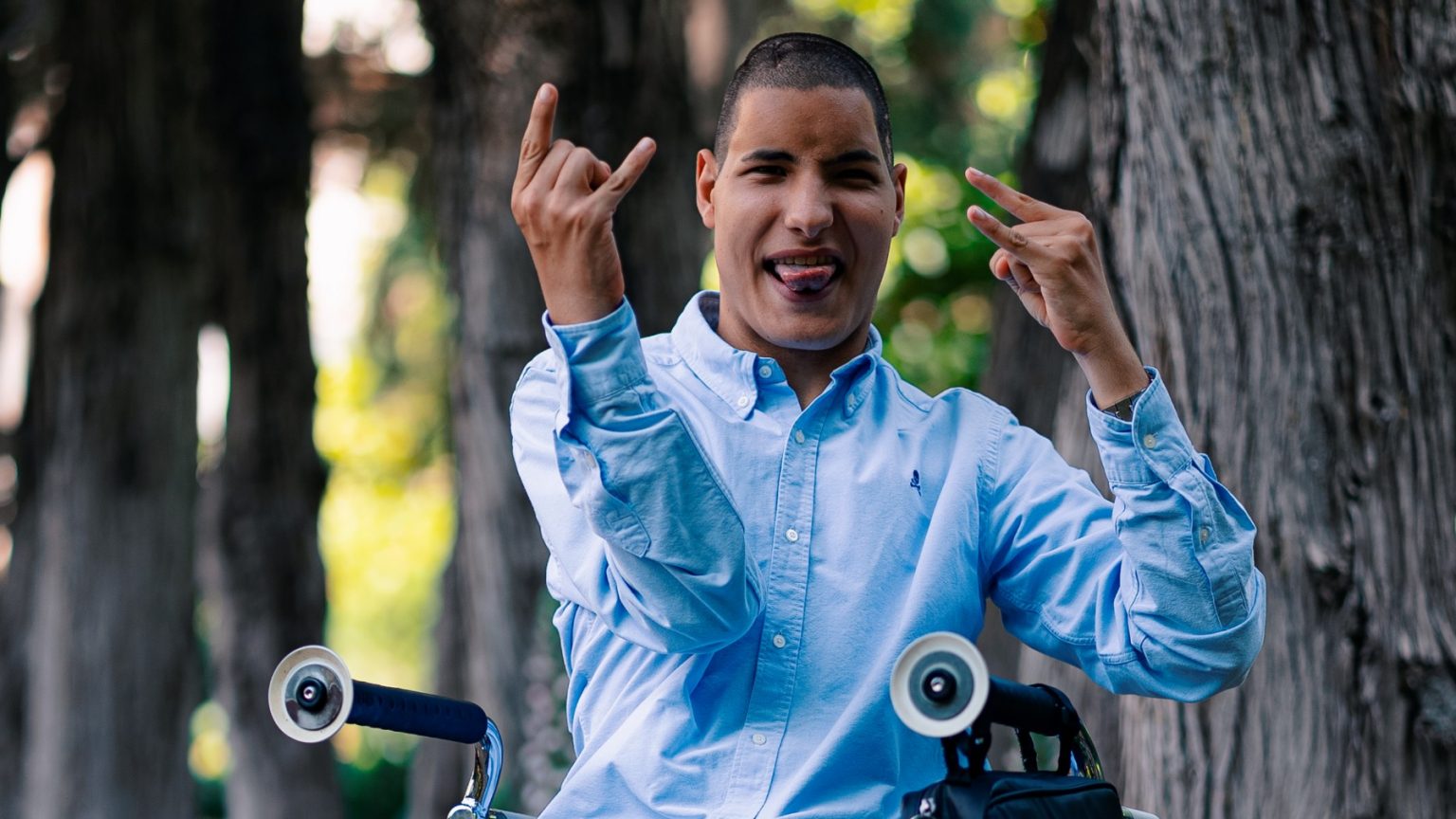 Así es la vida de Roque Star, el joven que sobrevivió a 50 cirugías