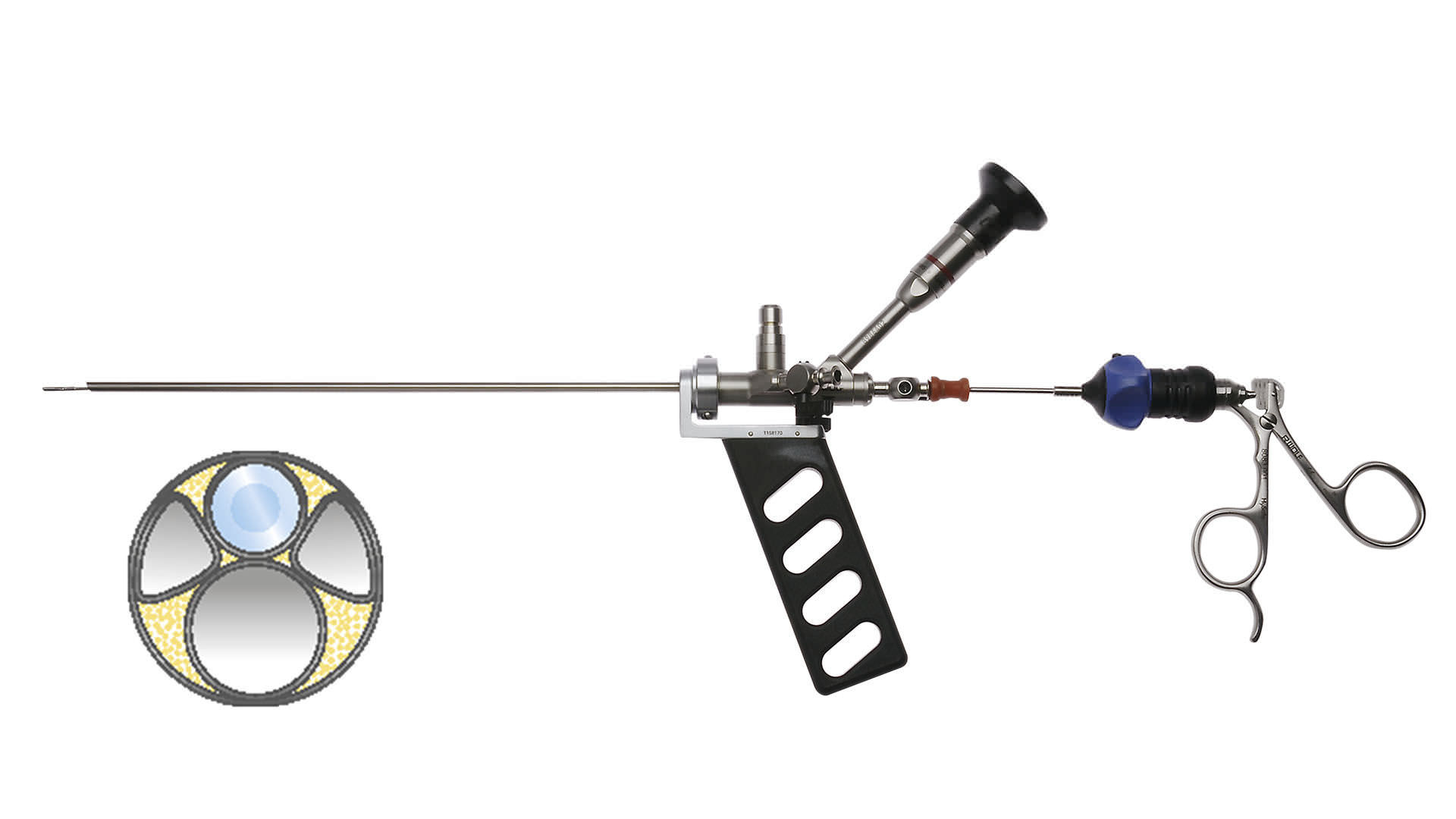 ¿Qué es la histeroscopia y cómo se realiza?