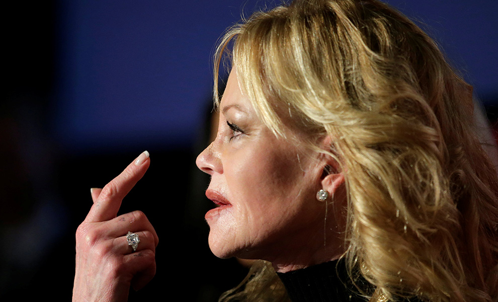 Melanie Griffith muestra las consecuencias de su cáncer de piel