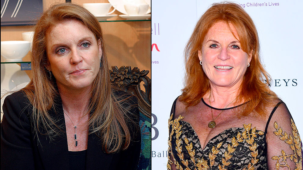 Así ha mejorado la cirugía el rostro de Sarah Ferguson