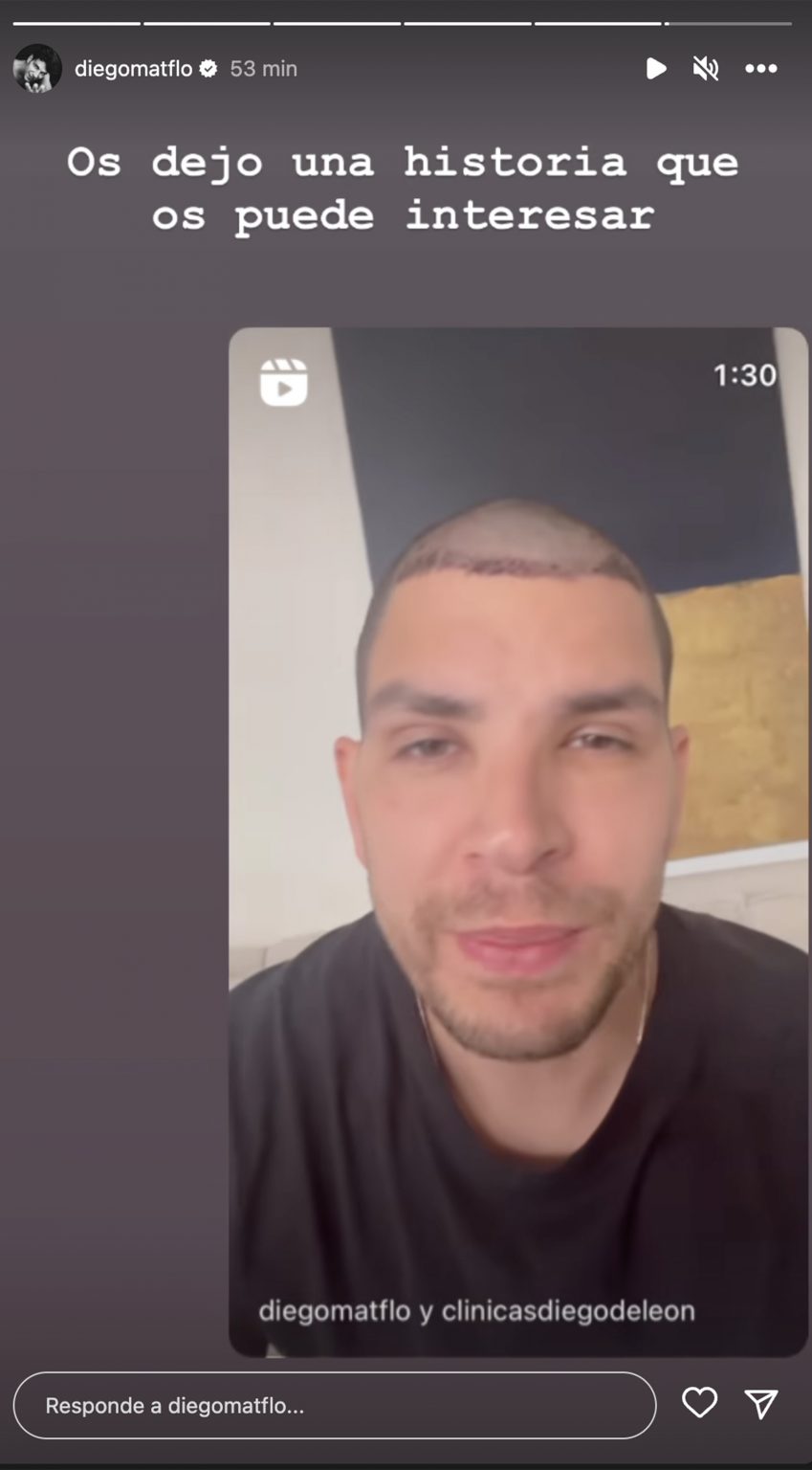 El inesperado retoque estético al que se ha sometido Diego Matamoros