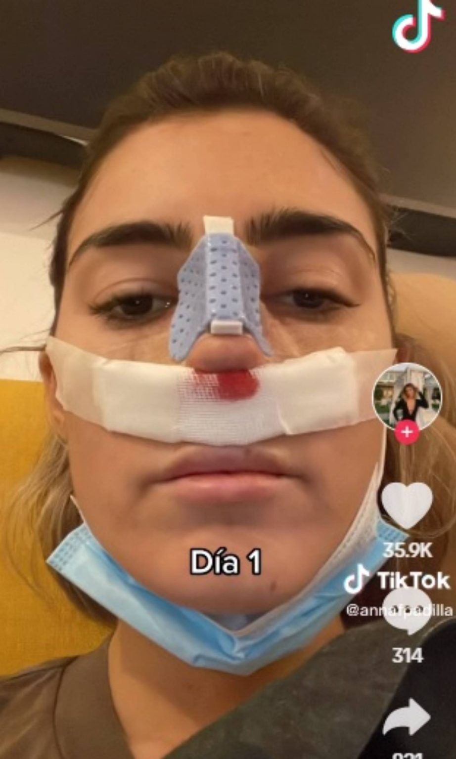 De Tamara Gorro a Loli Álvarez: los posoperatorios VIP más impactantes