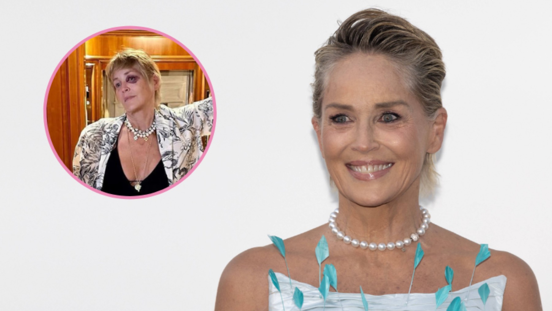 Sharon Stone preocupa al aparecer con un ojo morado en Turquía