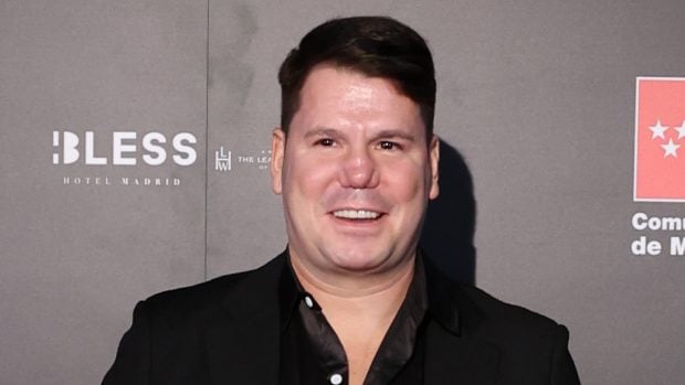 Lucas, su nariz y la última gran polémica de Andy & Lucas: "Estamos ...