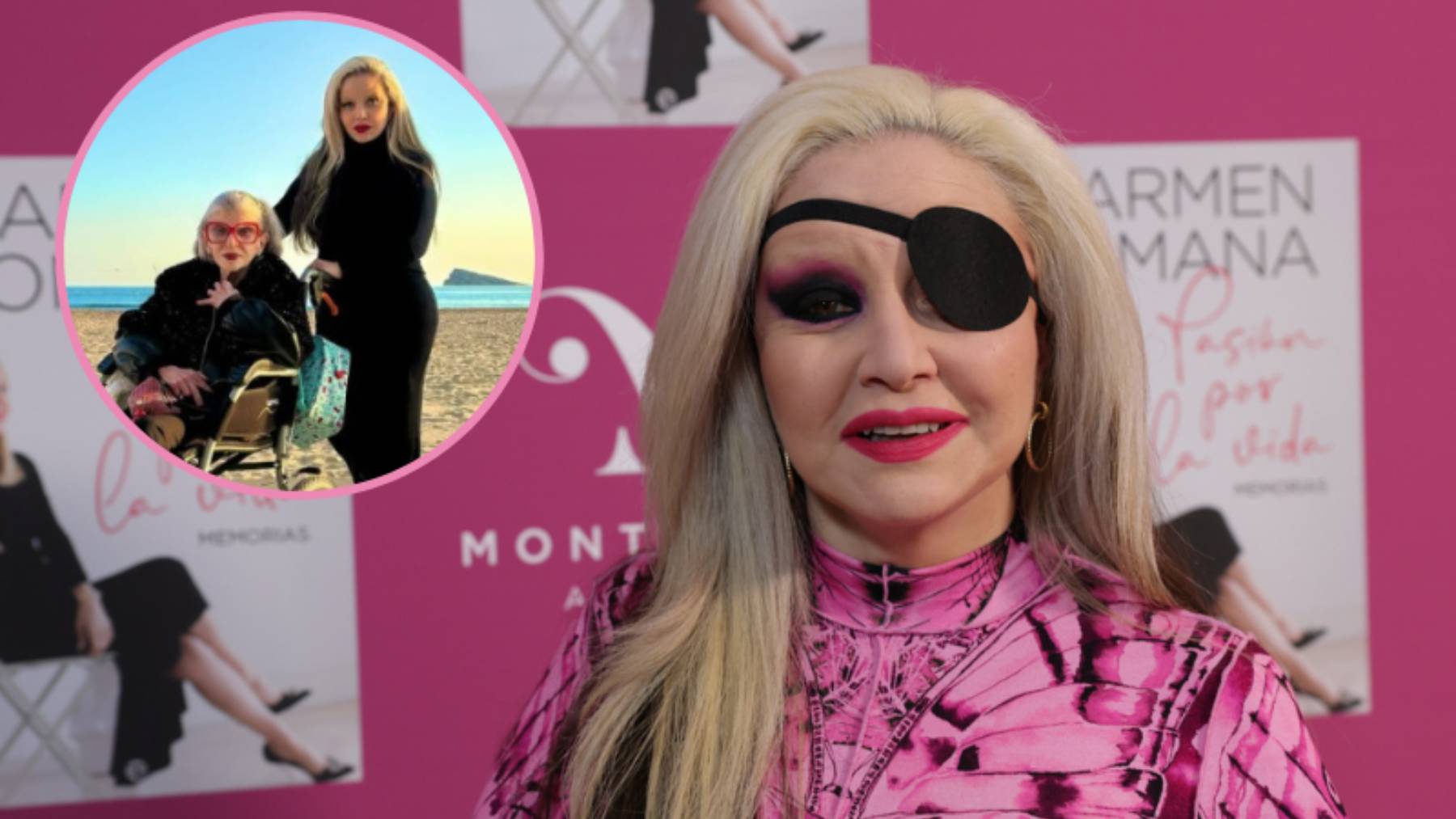 Alaska reaparece sin el parche de su ojo tras sufrir una trombosis ocular