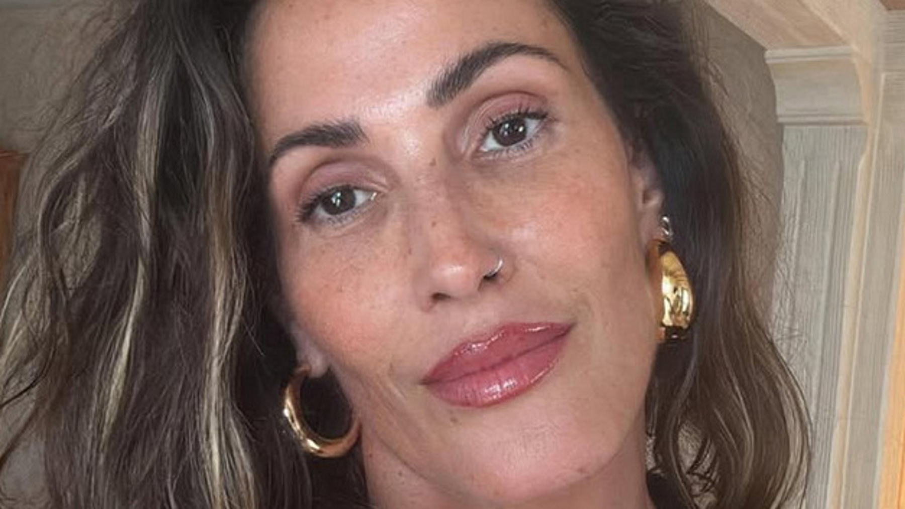 Una experta en medicina estética aplaude el cambio de Malú y desvela su ...