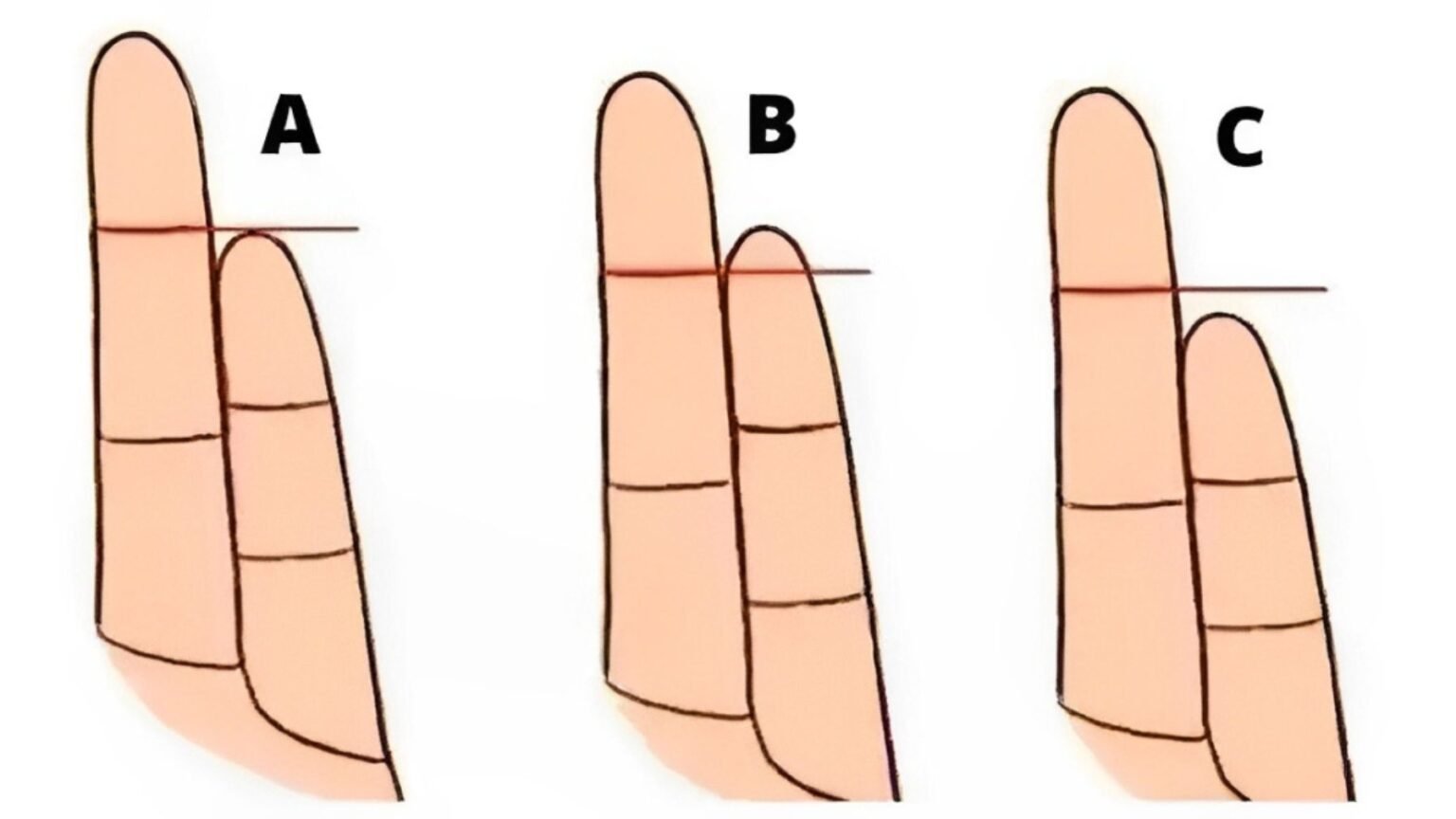Personality test: If your pinky finger has this shape, you are more ...